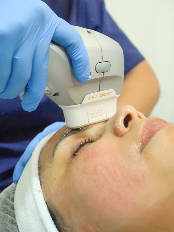 Hifu – Ultraformer